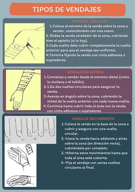 TIPOS DE VENDAJES | ZURIELA | uDocz