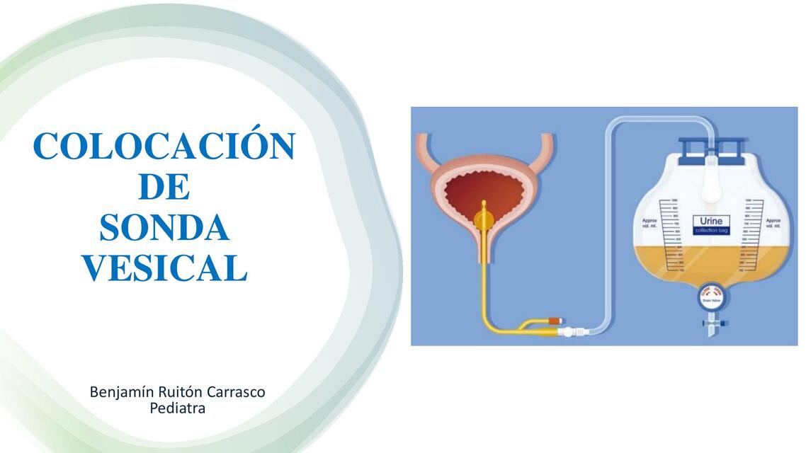 Flashcards de Colocación de sonda vesical | Por Sonia | uDocz