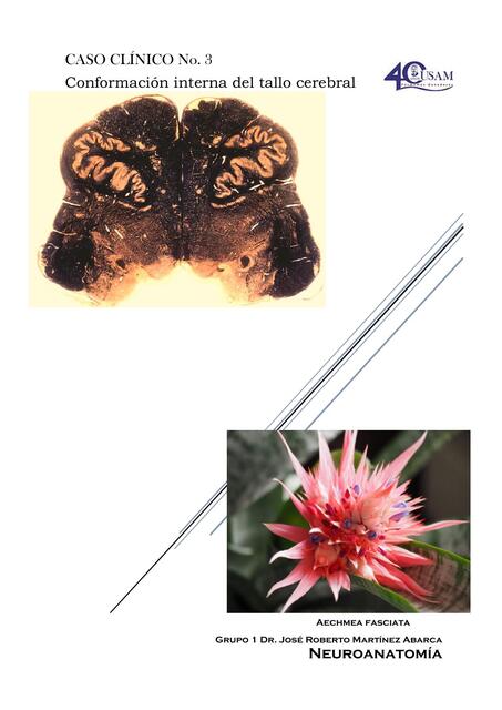 CASO CLÍNICO No 3 | Medical Student | uDocz