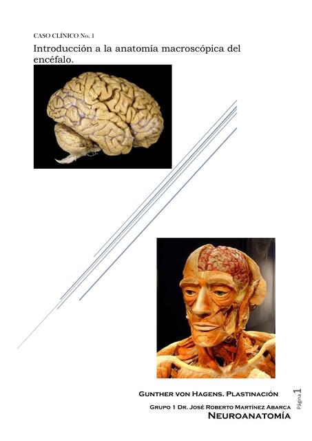 CASO CLÍNICO No 1 | Medical Student | uDocz