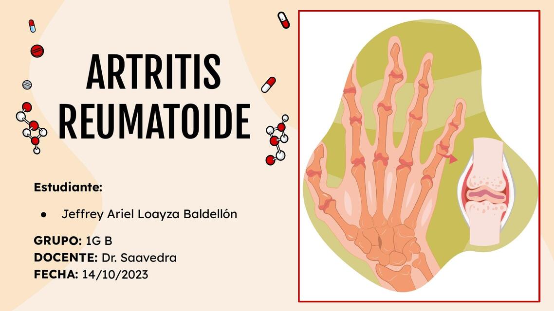 ARTRITIS REUMATOIDES | Summaries_med | uDocz
