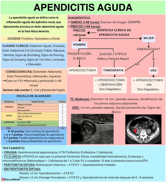 APENDICITIS AGUDA | Dr. Boris Moises Caillares Montaño | uDocz