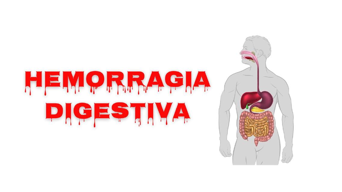 Flashcards de HEMORRAGIA DIGESTIVA alta y baja 2 | Por Dámaris Ato | uDocz