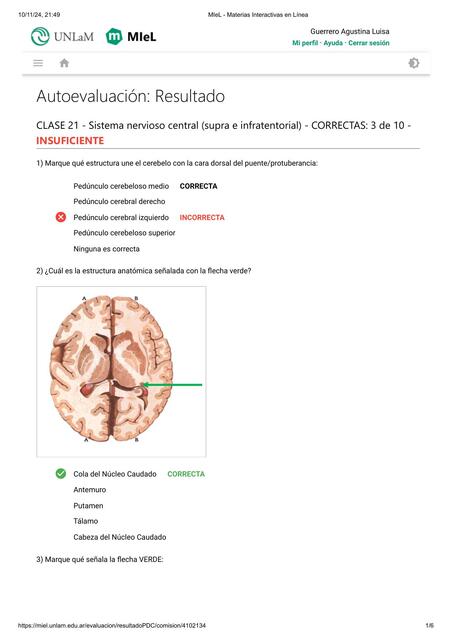 Neuro anato practica | Agustina Guerrero | uDocz
