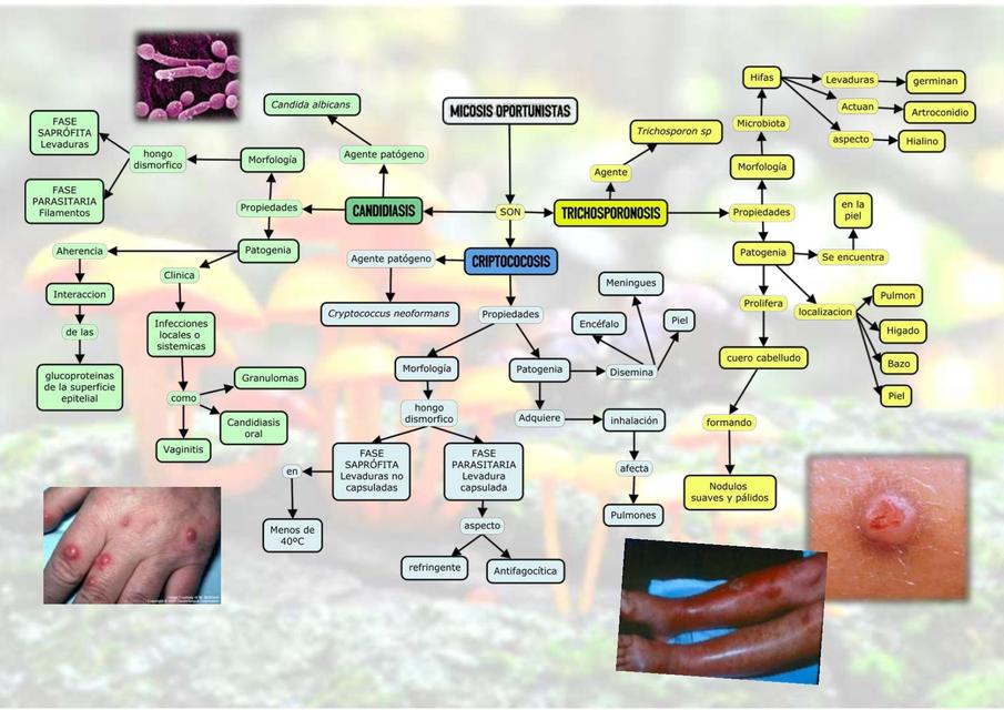 Micosis oportunistas | Salud | Apuntes de medicina | uDocz Micosis oportunistas | Salud | Apuntes de medicina | uDocz