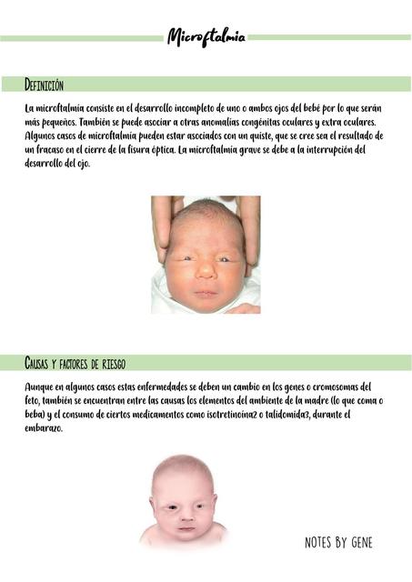 Resumen de Microftalmia | uDocz