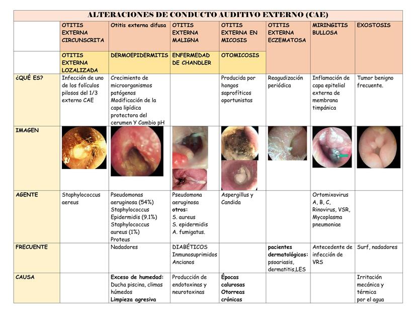 ALTERACIONES DE CONDUCTO AUDITIVO EXTERNO | Mayra Lucho Zárate | uDocz