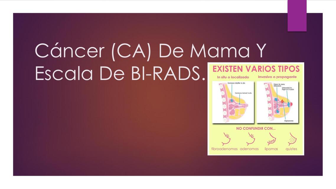 CA DeMama Birads | Joel | uDocz