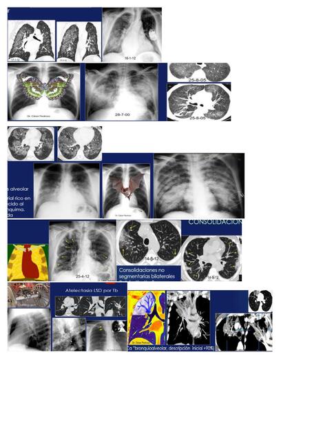 radiotorax | Catacora Espejo Mayra Magaly | uDocz