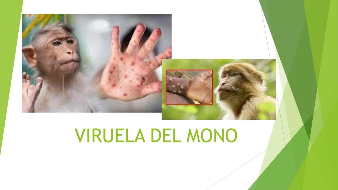 VIRUELA DEL MONO | MARIA LIZETH | uDocz