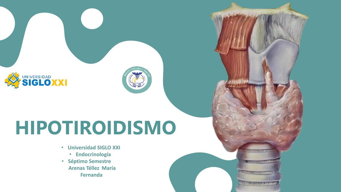 HIPOTIROIDISMO fer | Fernanda Arenas | uDocz