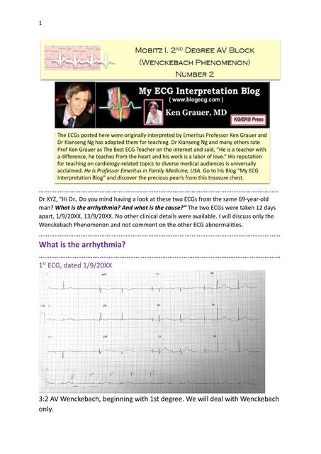 57 Wenckebach Part 2 | Yan | uDocz
