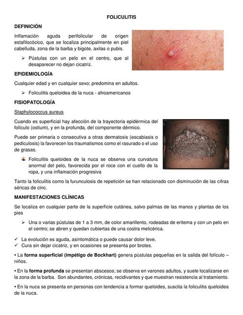 FOLICULITIS | Estudiante de medicina | Medicina | uDocz