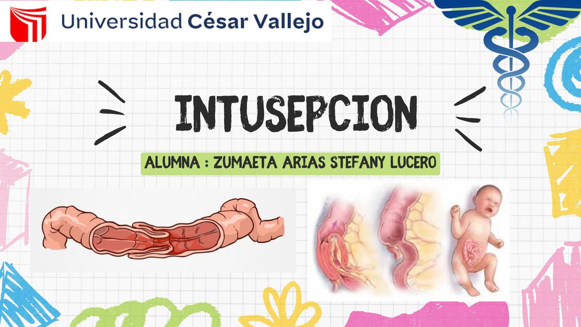 Flashcards de INVAGINACION 1 | Por Lucero Zumaeta | uDocz