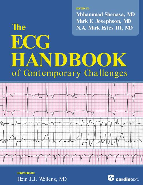 ECG HANDBOOK | Evelyn Sanchez Garcia | uDocz