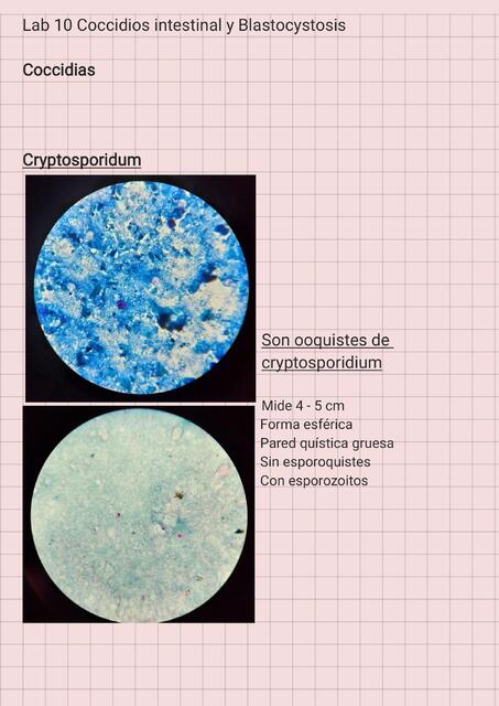 Coccidiosis intestinal y blastocystosis | Laddy Cch | uDocz