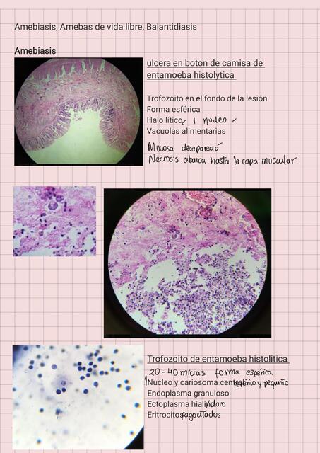 Amebiasis amebas de vida libre y balantidi | Laddy Cch | uDocz