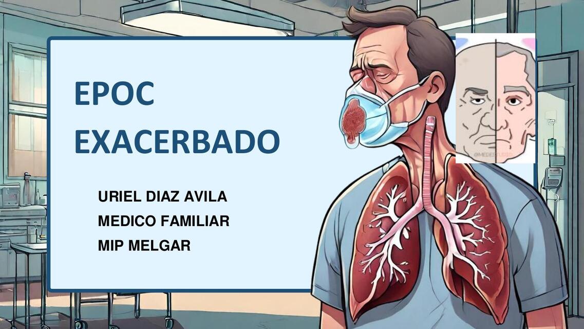 EPOC exacerbado | uriel diaz avila | uDocz