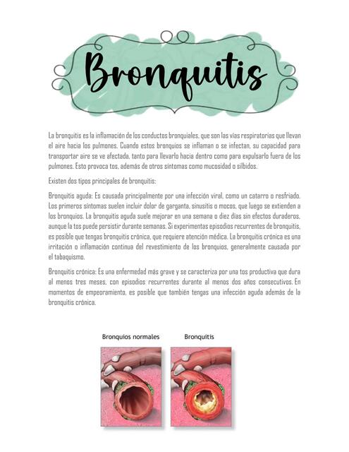 Flashcards de Bronquitis | Por Yazmin | uDocz