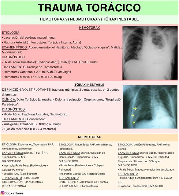 TRAUMA TORÁCICO | Dr. Boris Moises Caillares Montaño | uDocz