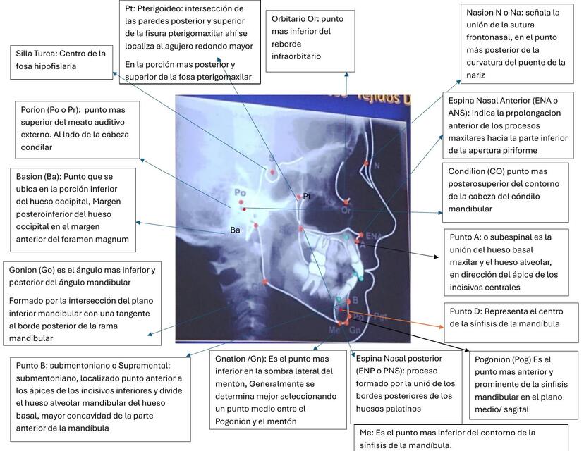 Cefalometría, puntos anatómicos básicos, Ortodoncia | Ingrid Vanessa ...
