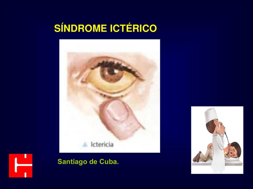 Semiologia del Sindrome icterico | Leodelquis | uDocz
