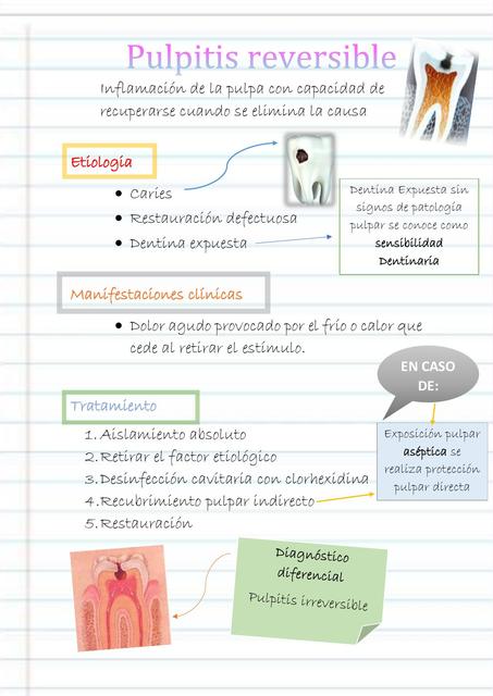 Pulpitis Reversible | uDocz creators | uDocz