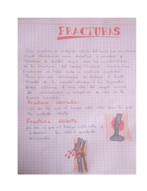 soporte basico | SHEILA NAYELI ORTEGA SANDOVAL | uDocz