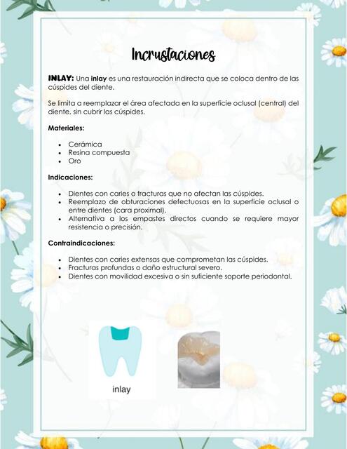 Incrustaciones inlay, onlay, overlay | Carmen | uDocz