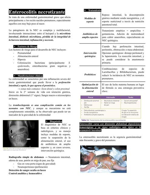 Enterocolitis Necrotizante | Romina Garza | uDocz
