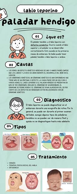 Infografía labio leporino y paladar hendido | Helen | uDocz