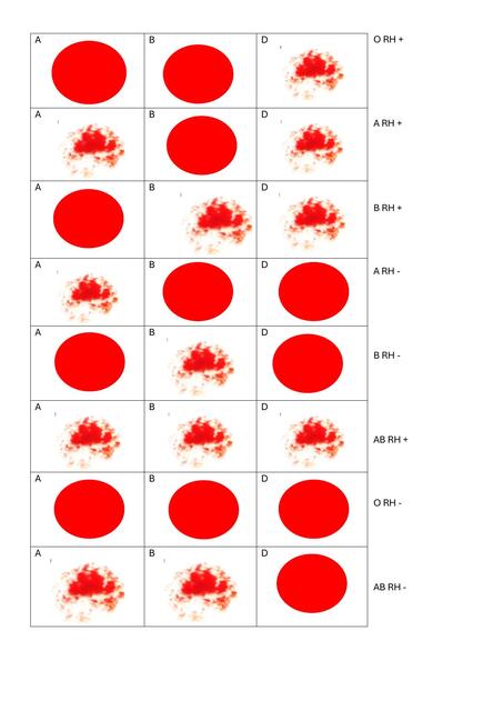 Tipos de sangre en placas con reactivos | Hilary Santos | uDocz