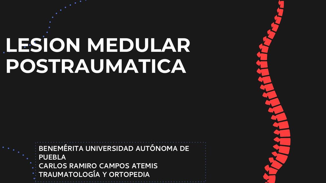 LESION MEDULAR TRAUMATICA | Campos Atemis | uDocz
