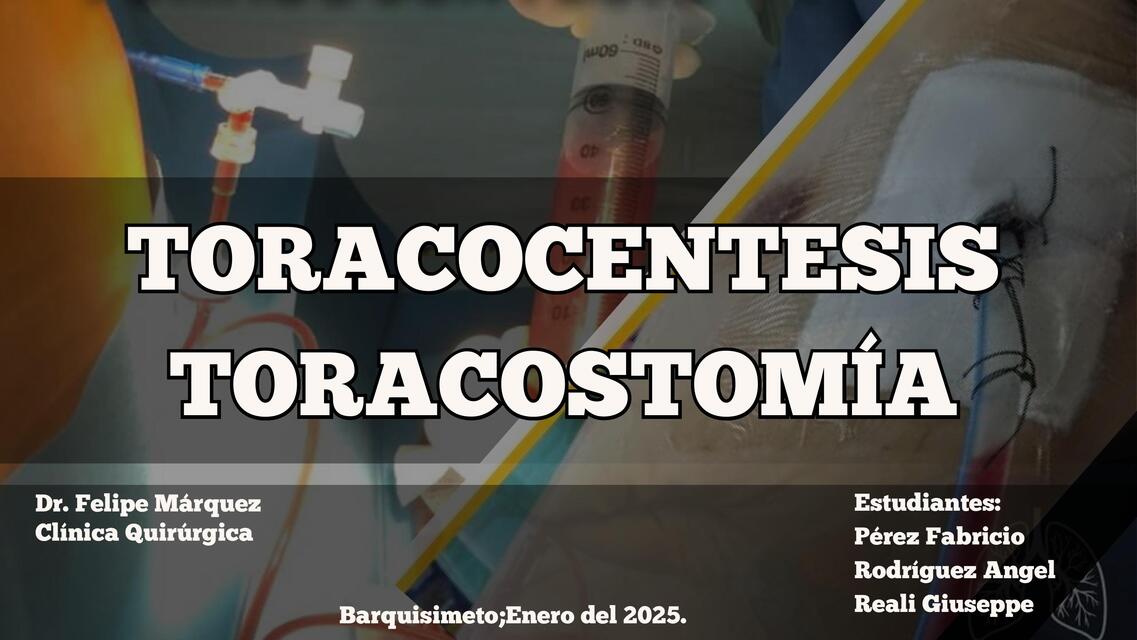 TORACOCENTESIS Y TORACOSTOMIA | Fabricio | uDocz