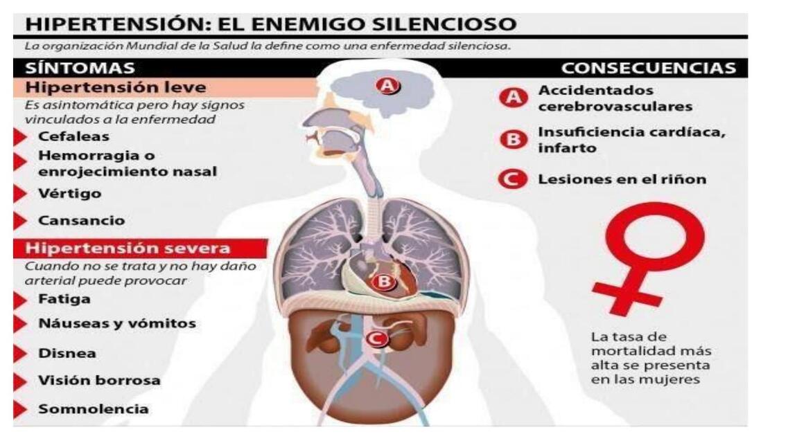 hta pro | RUBEN JIMENEZ | uDocz
