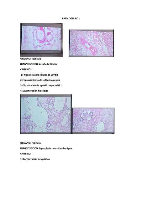 PC 1 2 SEMANA | lianxing chen | uDocz