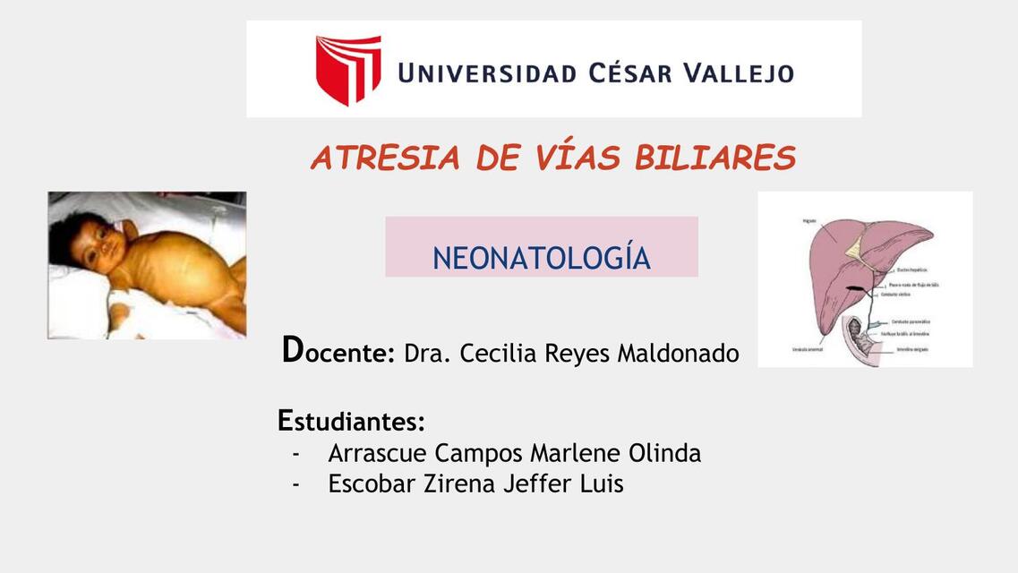 Atresia de vías biliares | Marlene Olinda Arrascue campos | uDocz