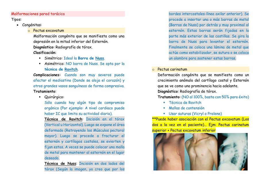 Malformaciones del tórax (Pectus excavatum y carinatum) | Jorge | uDocz