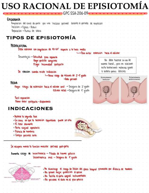Episiotomia | Alexia Hernandez | uDocz