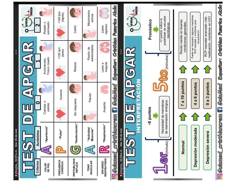 escalas pediatricaas | Sofia | uDocz