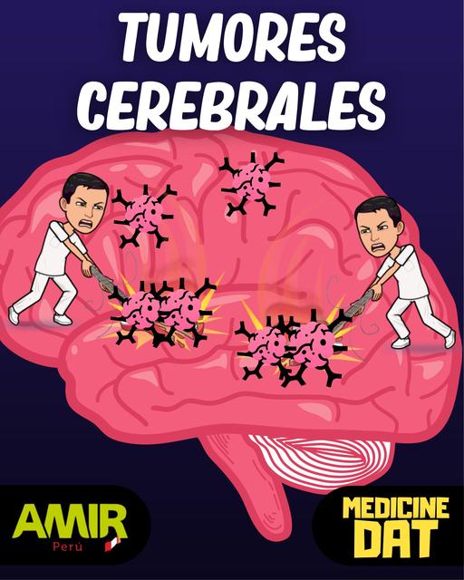 RESUMEN SOBRE TUMORES CEREBRALES | MedicineDat | uDocz