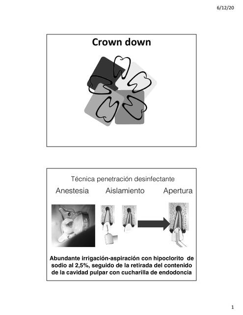 Técnica Crown Down (Corono Apical) | JESUS RIVERA | uDocz