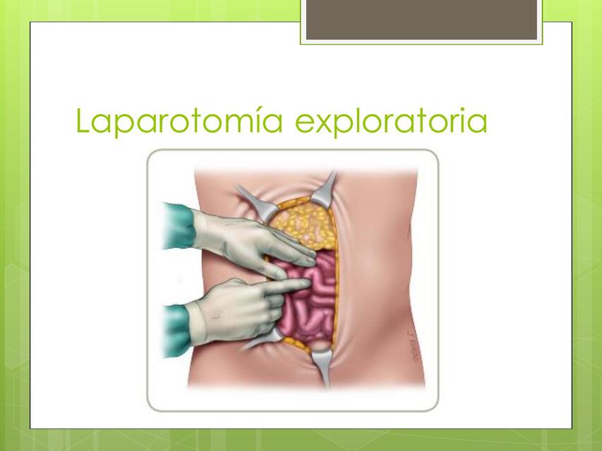 LAPE 1 | Angeles Hernandez | uDocz