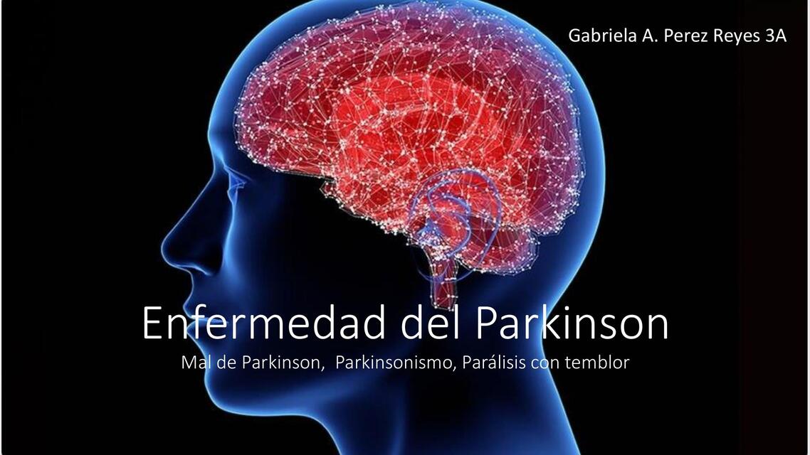 Parkinson | Rodiz | uDocz