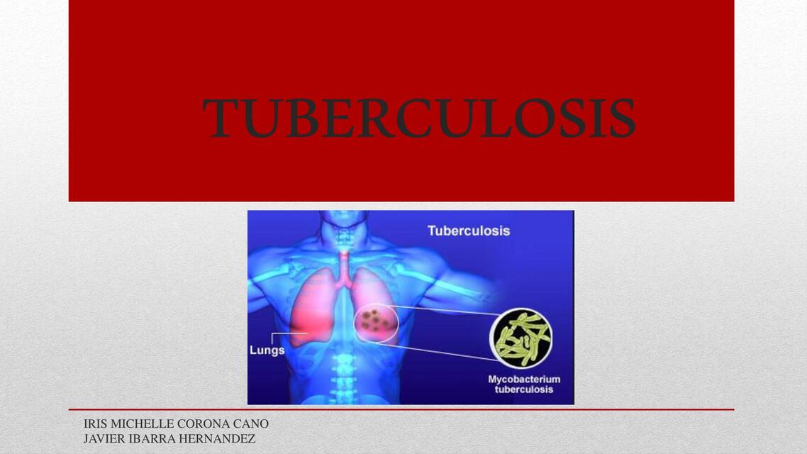11 TUBERCULOSIS | Rodiz | uDocz