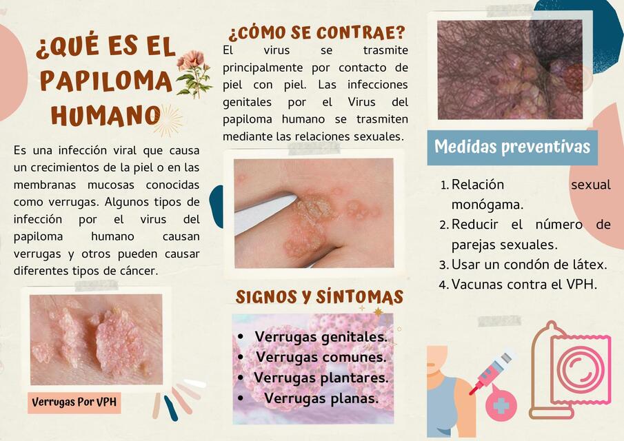 Papiloma HUmano | Yanely | uDocz