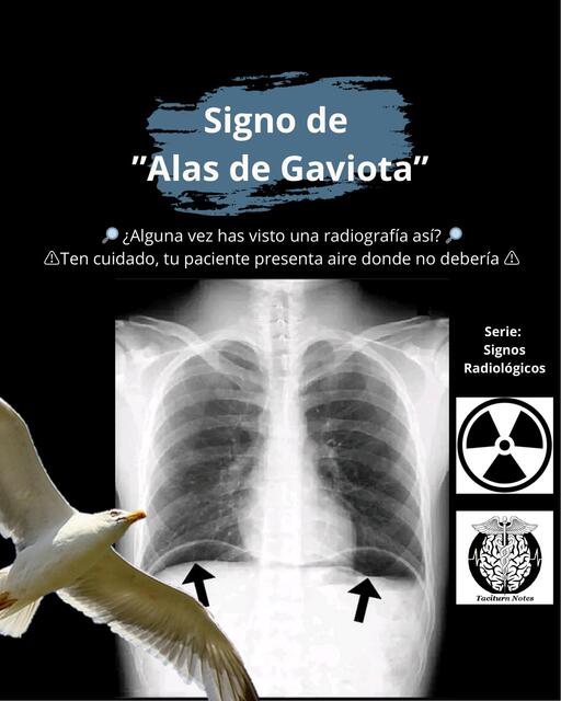 Signo de Alas de Gaviotas | Taciturn Notes | uDocz