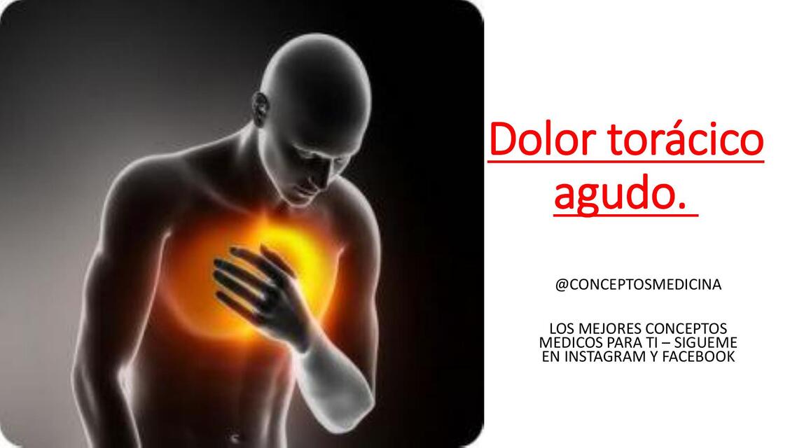 dolor toracico agudo | Fernando Lotti | uDocz