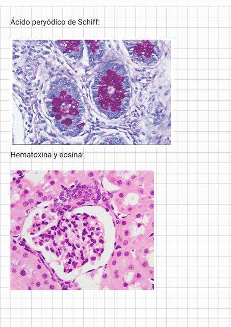 Tinciones | Pau | uDocz