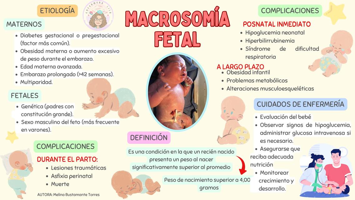 MACROSOMÍA FETAL | Melina | uDocz